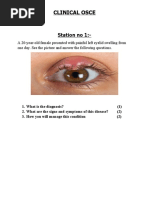 Fundamental OSCE Guide in Ophthalmology | PDF | Glaucoma | Medicine