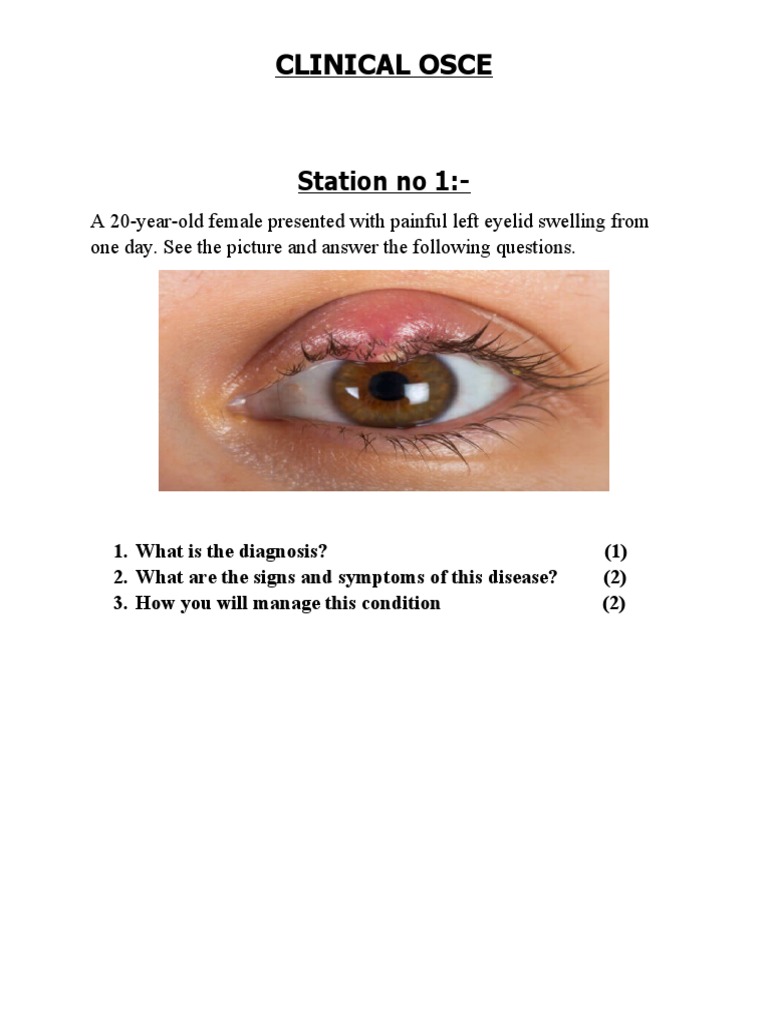 OSCE Ophthalmology | PDF | Medical Diagnosis | Eye