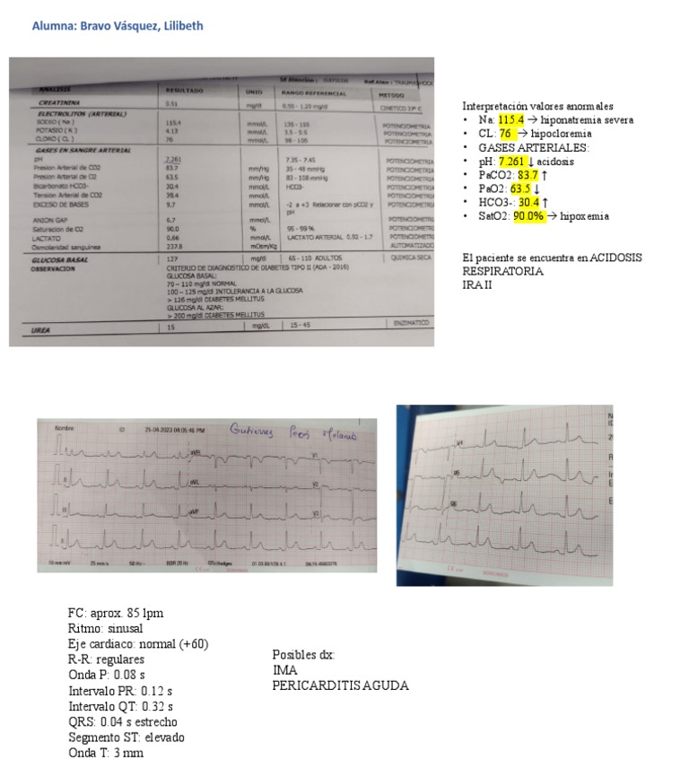 Interpretación Aga y Ekg | PDF