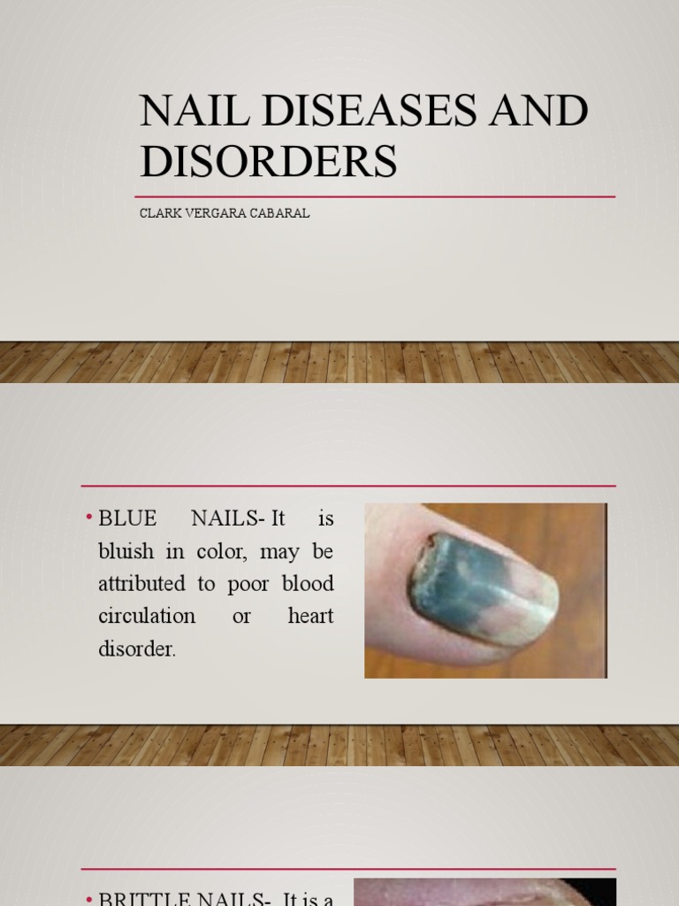 Common Nail Diseases and Disorders | PDF