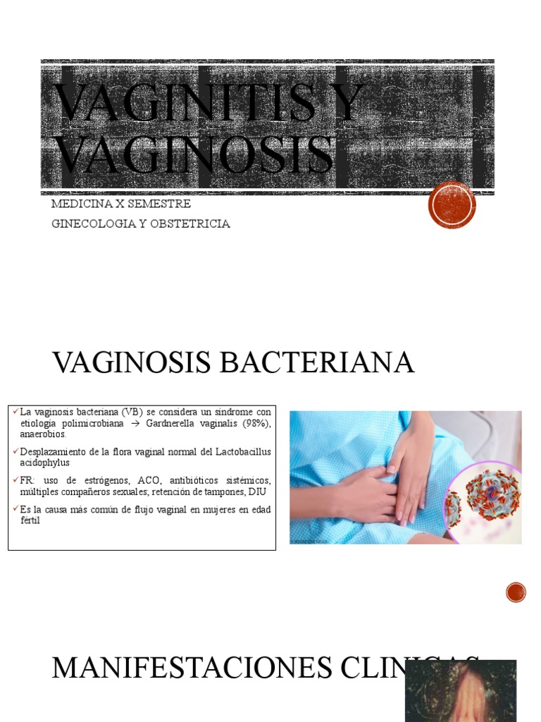Vaginitis y Vaginosis | PDF