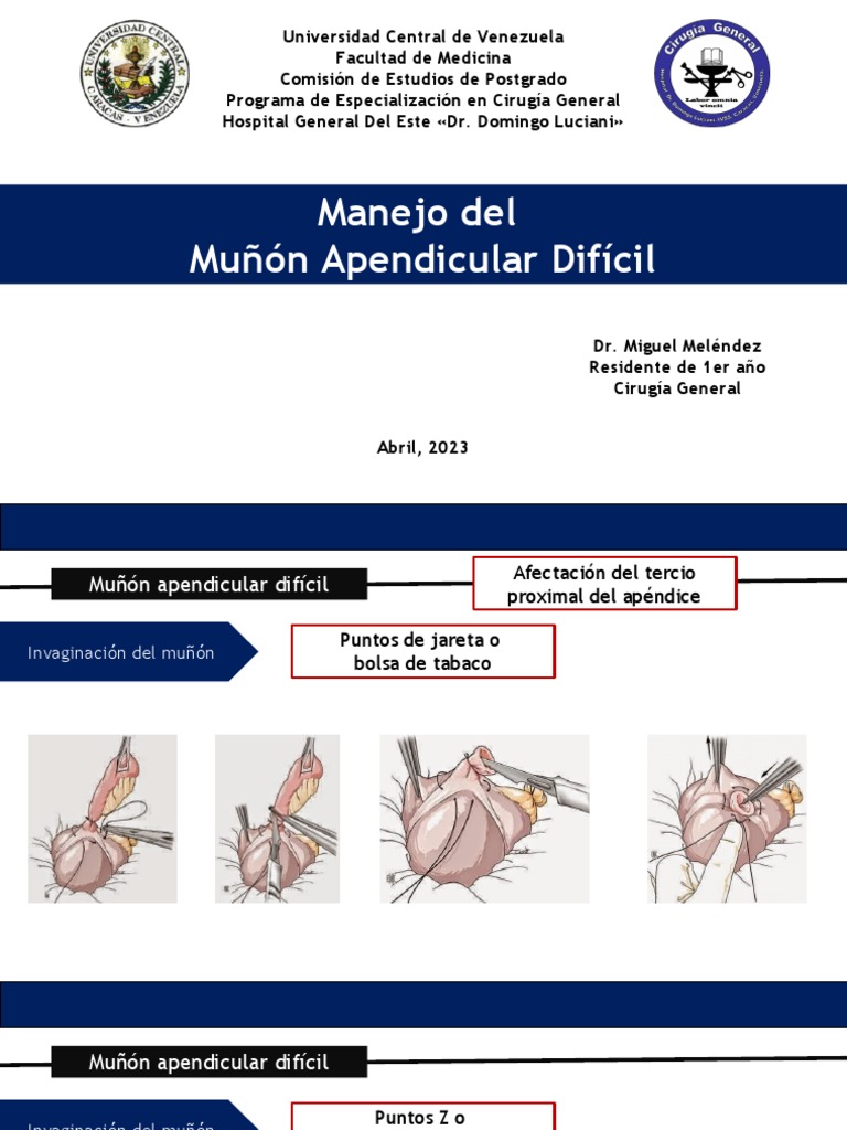 Manejo de Muñon Dificil | PDF
