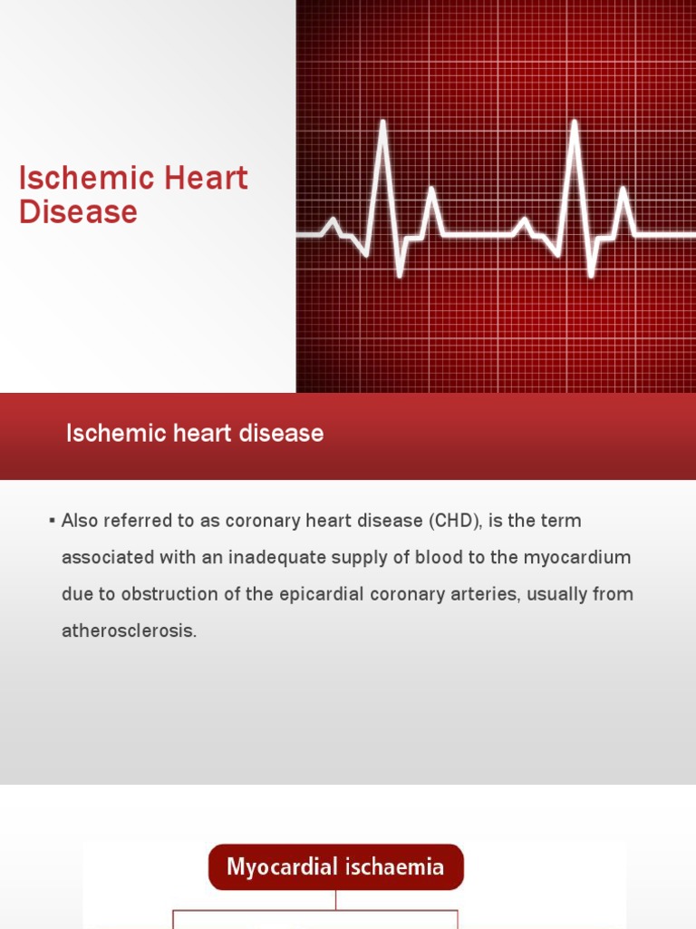 Ischemic heart diease .pdf | PDF