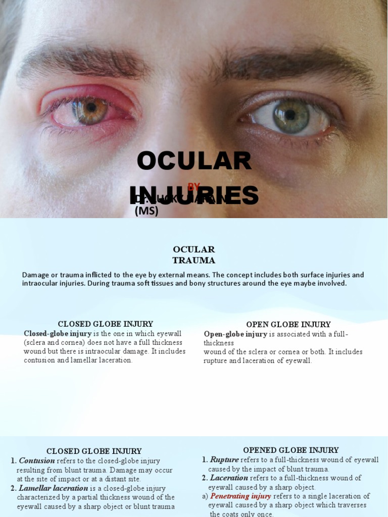 Open Globe Injury Overview | PDF