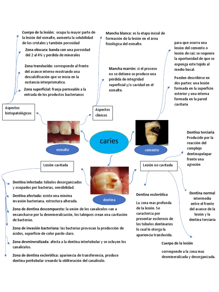 Caries Mapa Mental | PDF