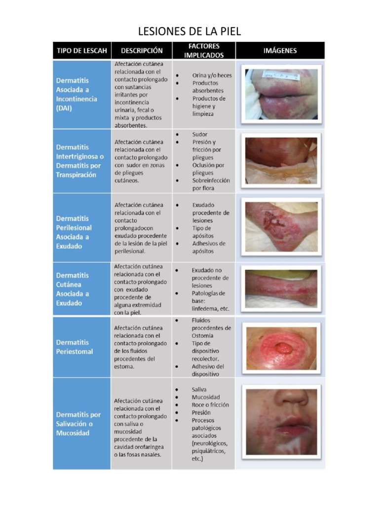 Ulceras Por Presión y Escalas Upp | PDF