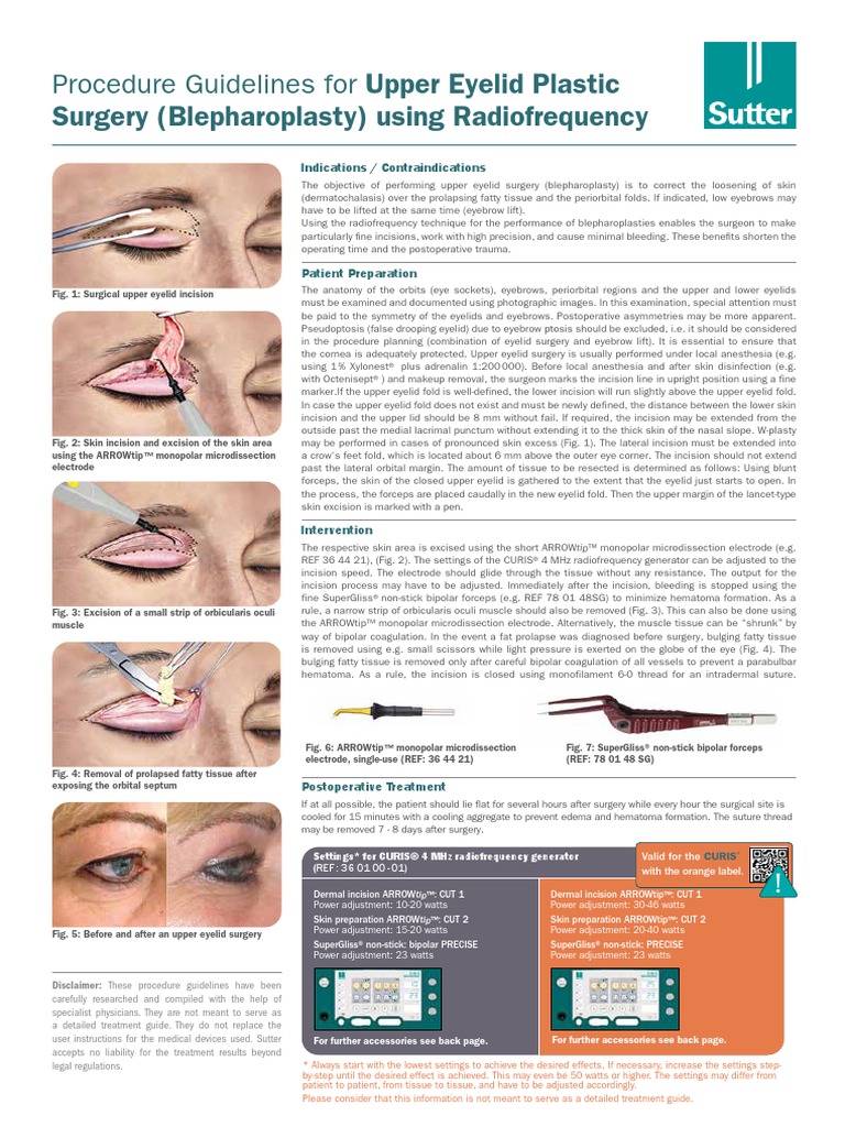 Procedure Guideline - Upper Eyelid Plastic - EN - 1243D - LowRes PDF | PDF