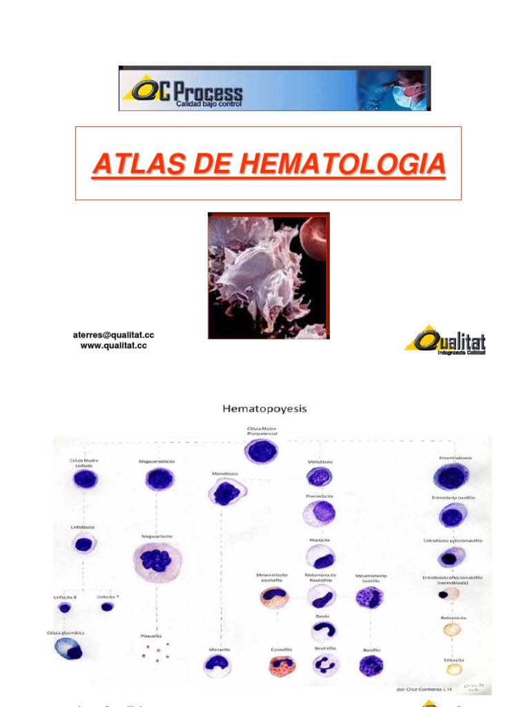 Atlas de Hematologia Atlas de Hematologi PDF | PDF | Especialidades ...
