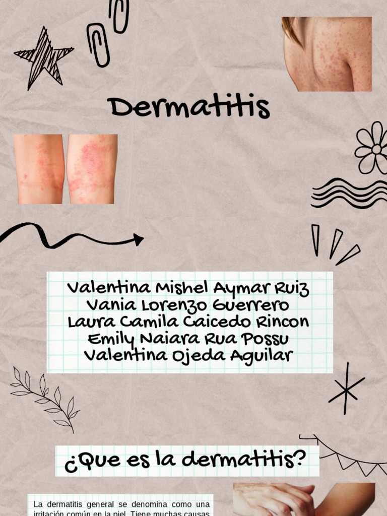 Dermatitis PDF | PDF