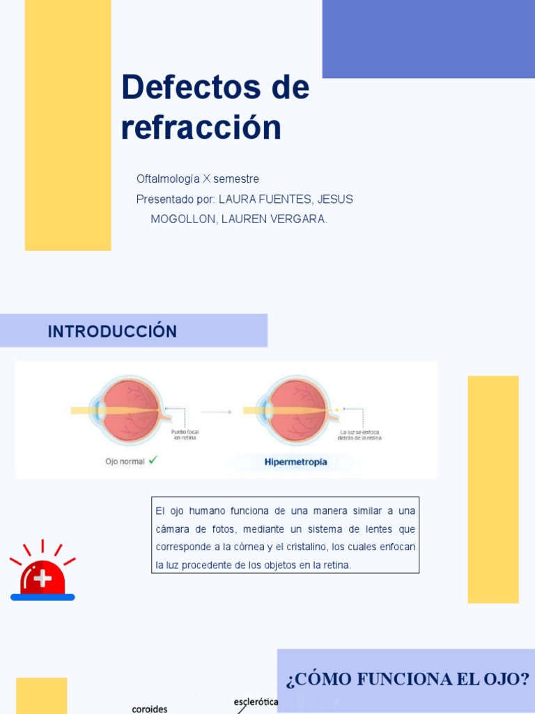 Defectos de Refracción Ocular | PDF