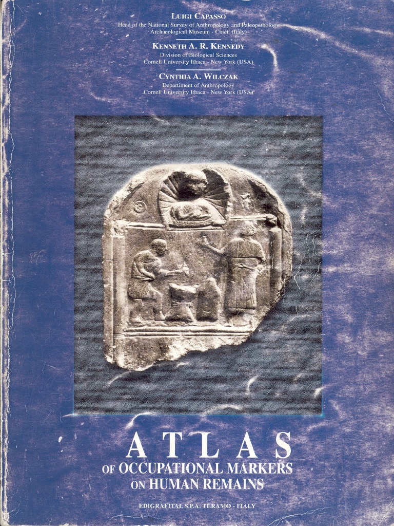 CAPASSO, KENNEDY, WILCZAK-Atlas of Occupational Markers On Human ...