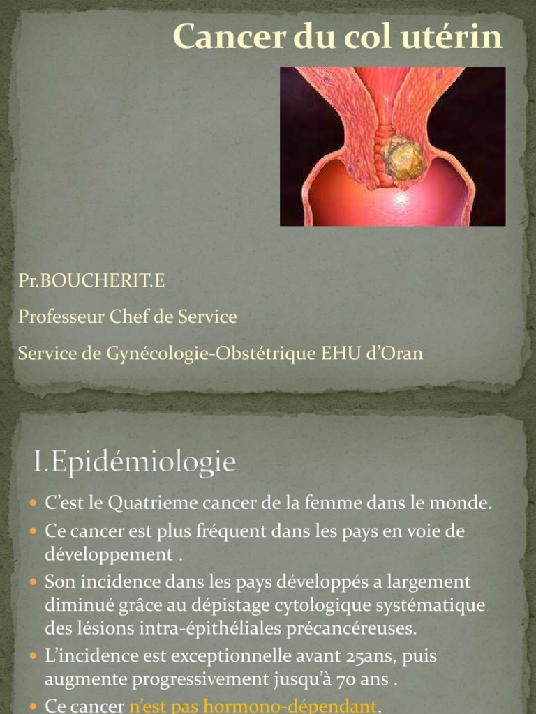 Cancer du col utérin : Épidémiologie et traitement | PDF
