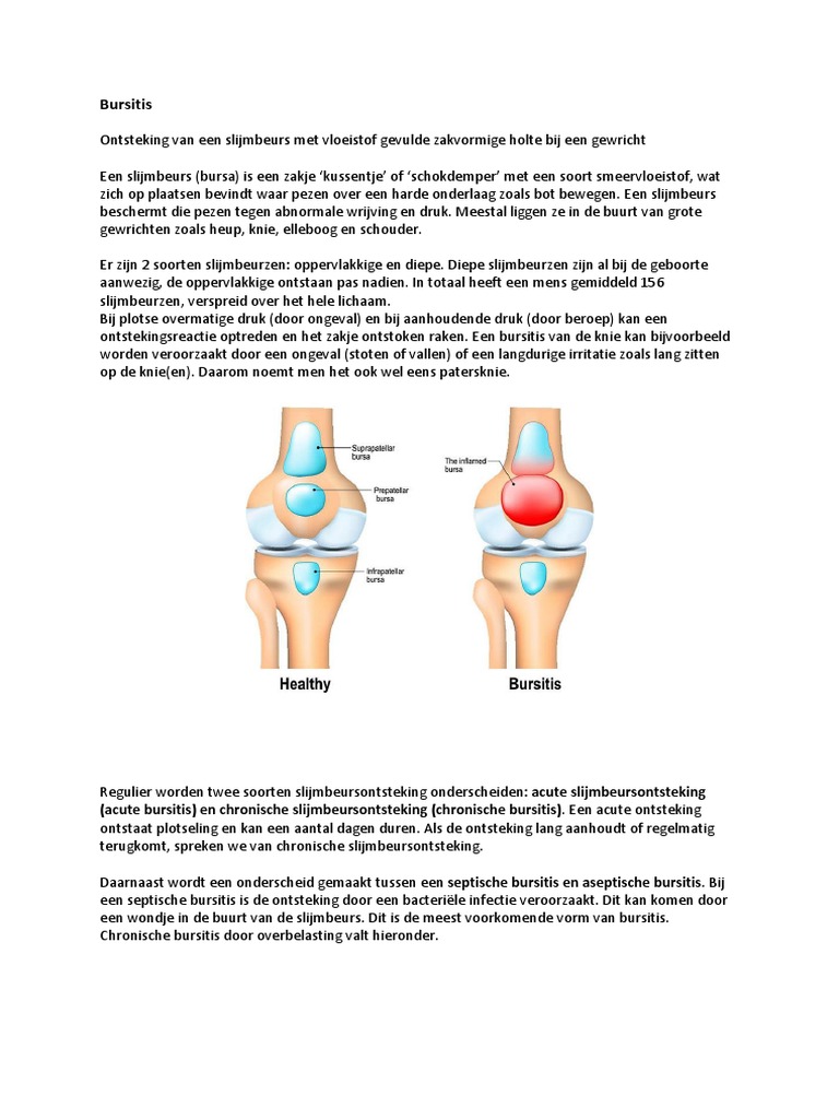 Bursitis | PDF