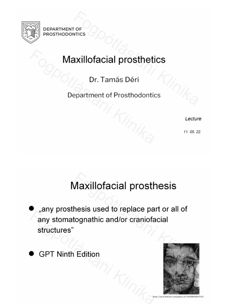 Maxillofacial Prosthetics PDF | PDF | Dental Implant | Prosthesis