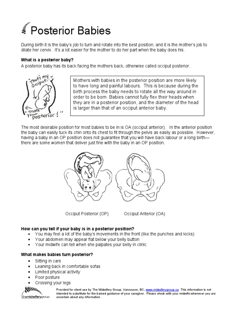 Posterior Babies: How to Prevent and Encourage Rotation | PDF
