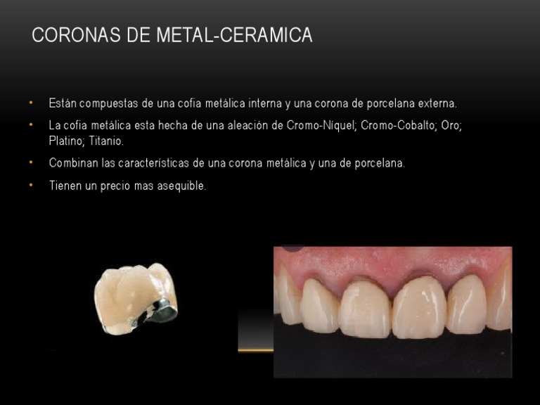 Coronas | PDF