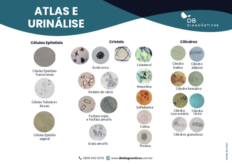 DB Cartaz Atlas Urinalise Comlogo | PDF