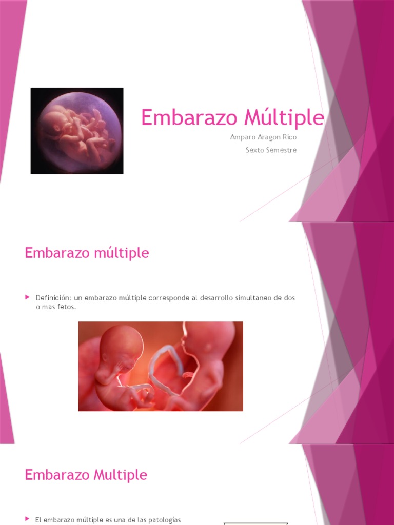 Embarazo Múltiple | PDF