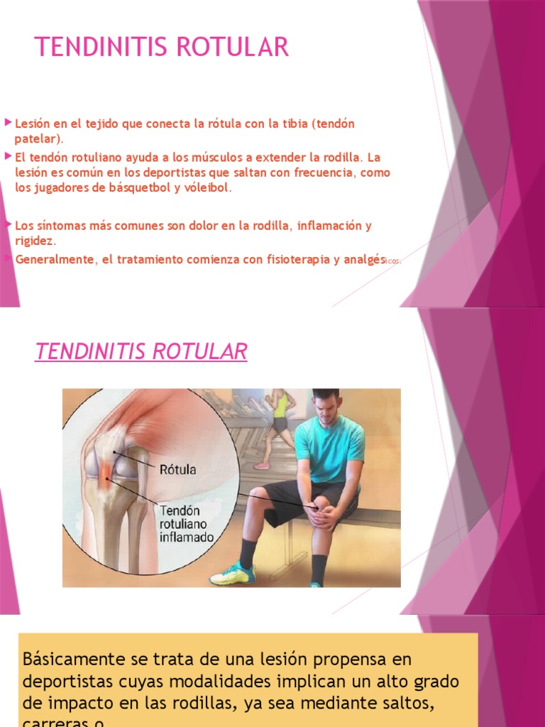 Tendinitis Rotular | PDF