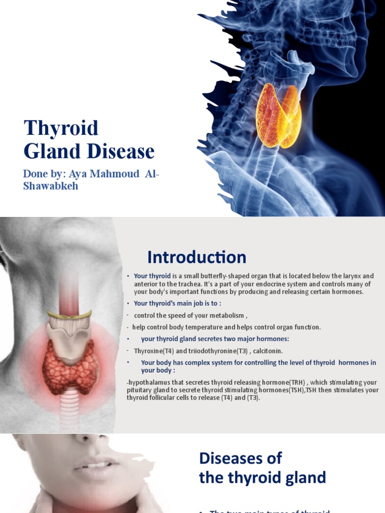 Presentation4 - Mahh | PDF