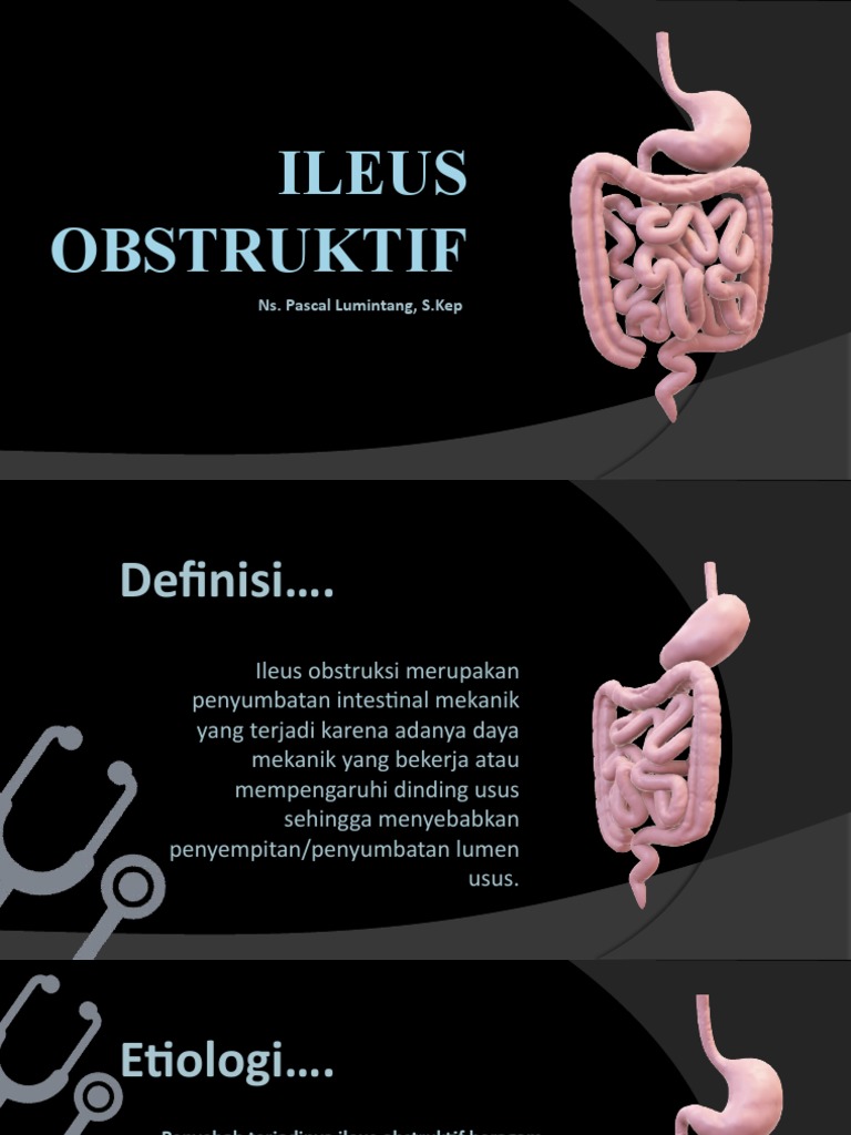 Ileus Obstruksi | PDF