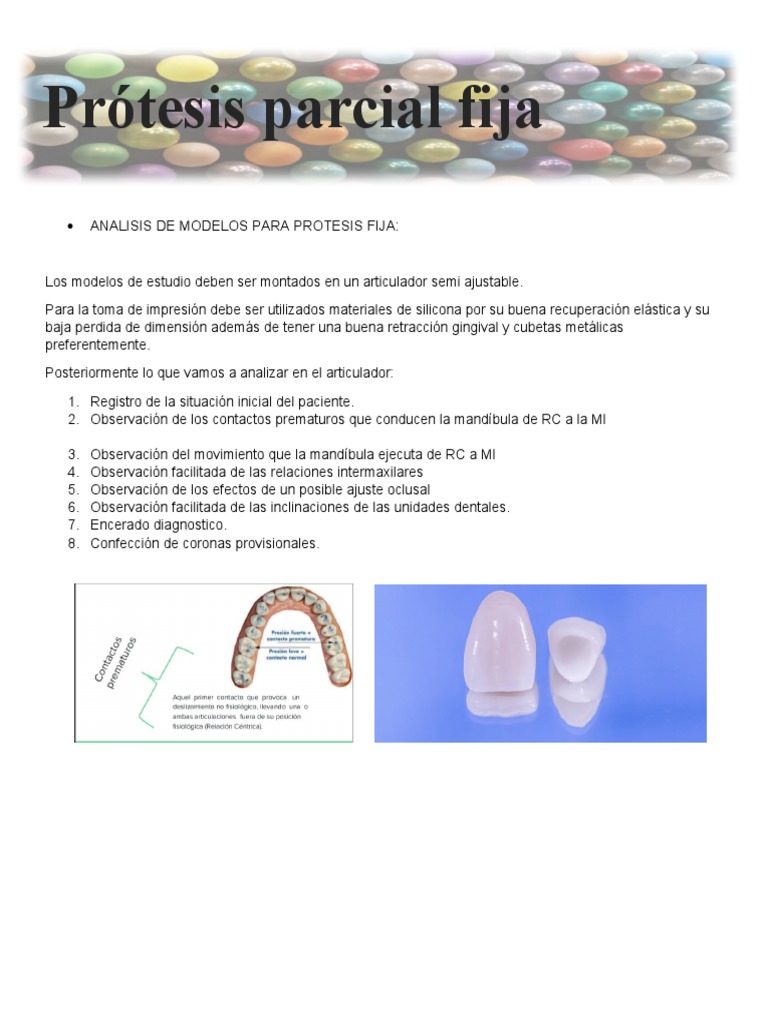 Analisis de Modelos para Protesis Fija | PDF