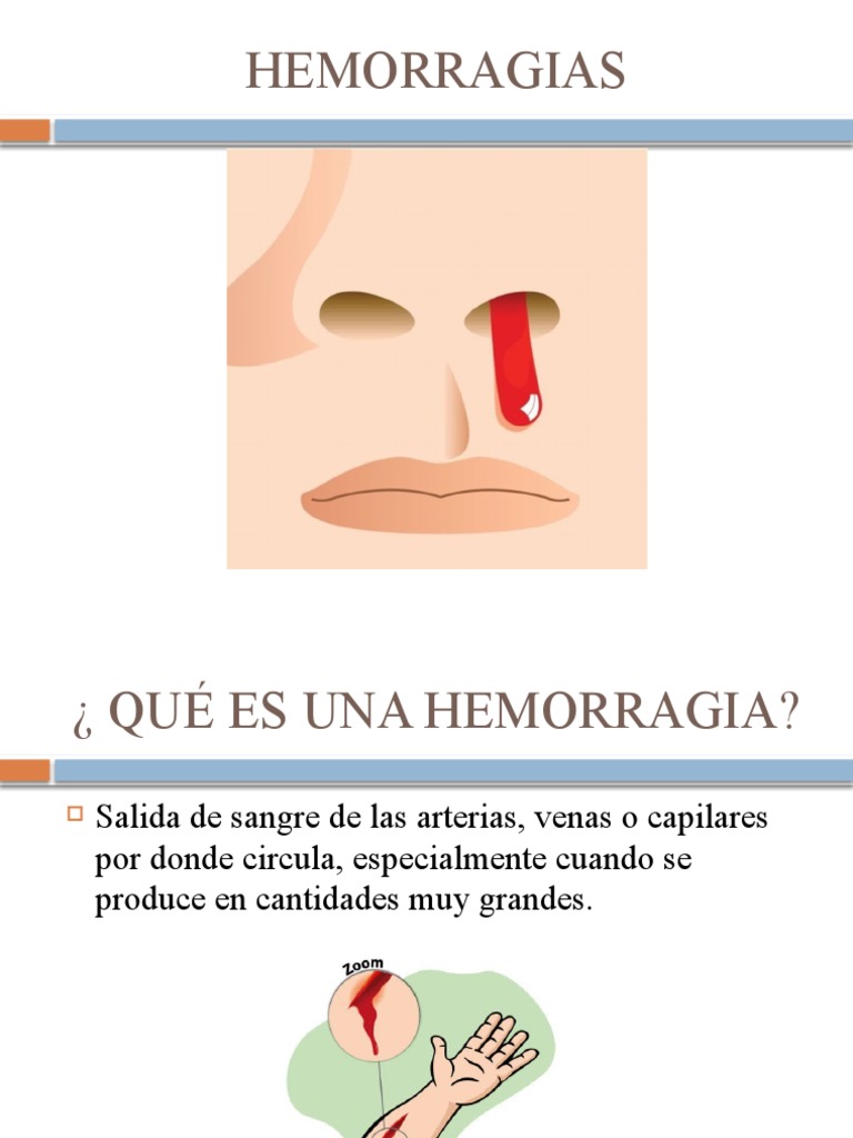 HEMORRAGIAS.pptx | PDF | Artería | Sangrado