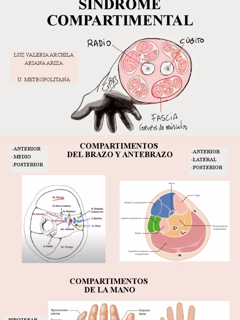 Sindrome Compartimental | PDF