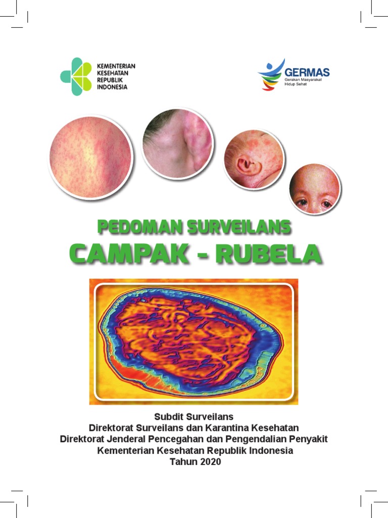 PEDOMAN Campak Dan Rubela 2020 | PDF