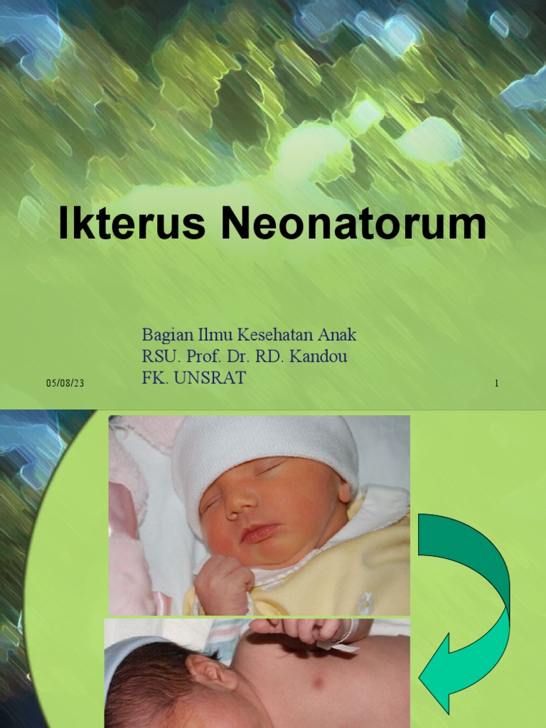 Ikterus Neonatorum | PDF