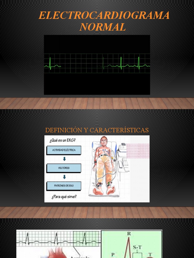 Electrocardiograma Normal | PDF