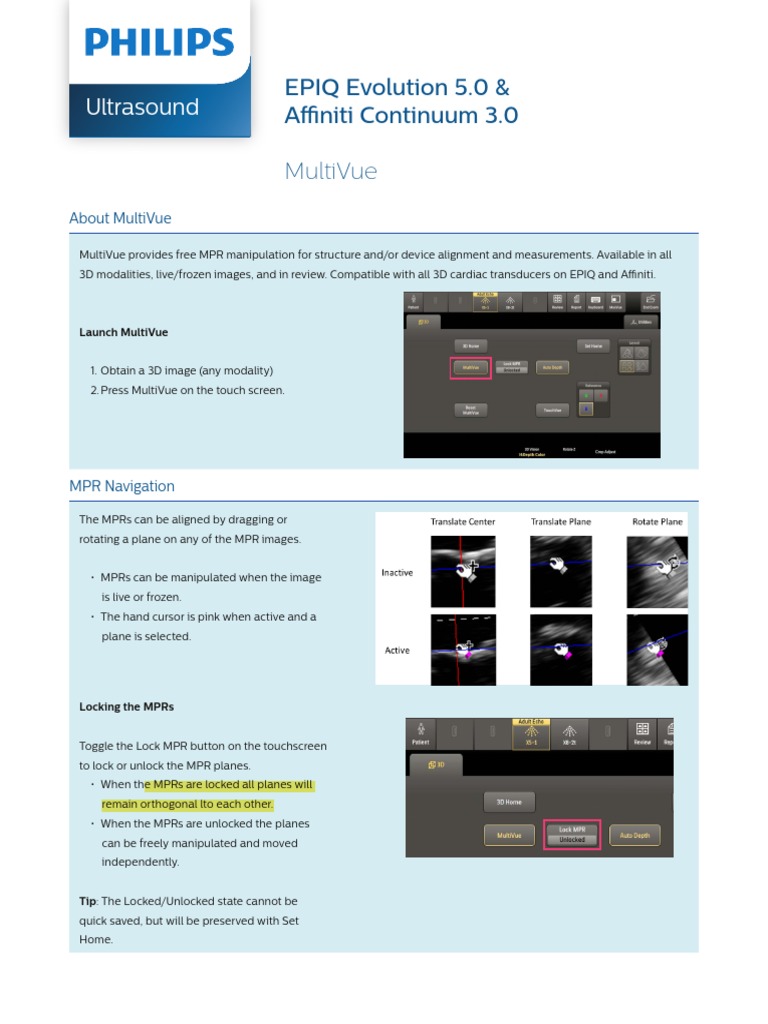 MultiVue Quick Guide (EPIQ Evolution 5.0 & Affiniti Continuum 3.0) Newpdf | PDF | Touchscreen ...
