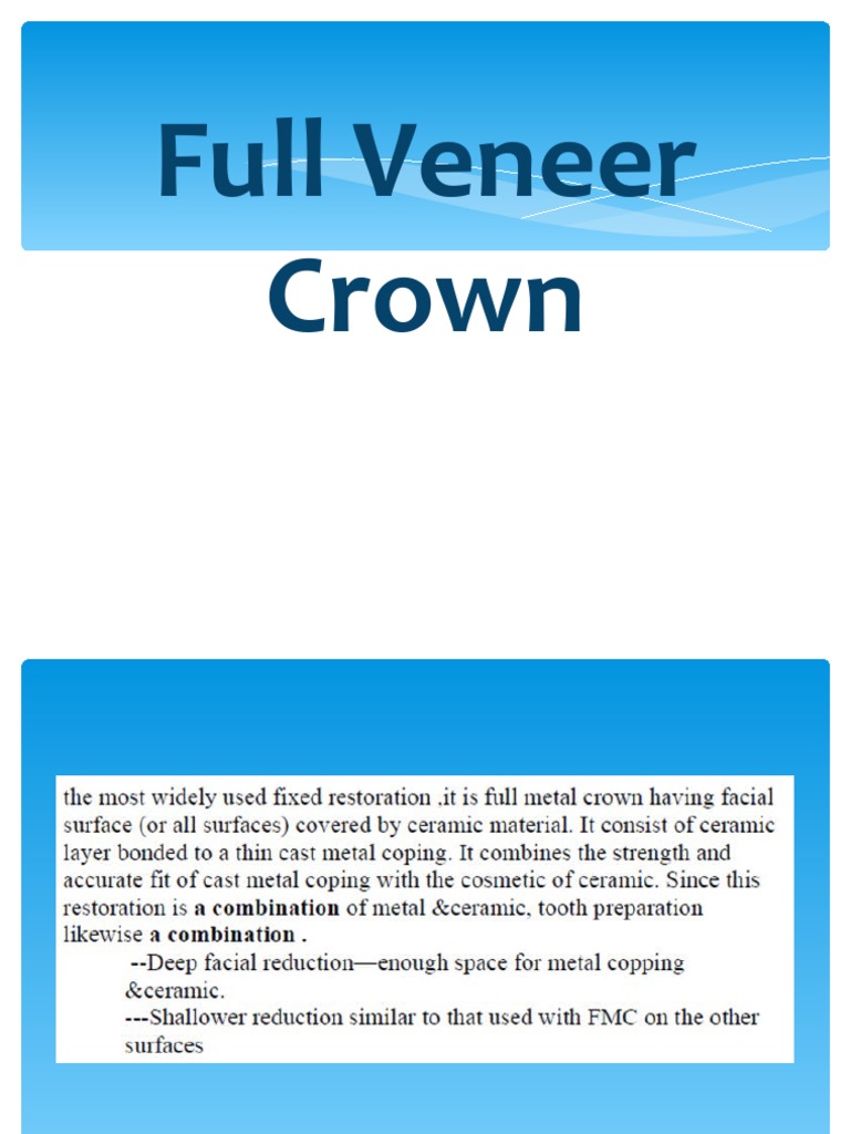 Full Veneer Crown | PDF
