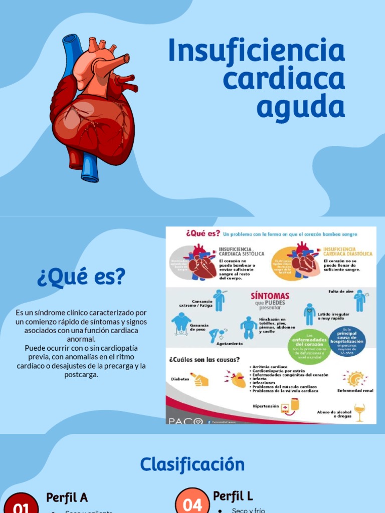 Insuficiencia Cardíaca Aguda: Diagnóstico y Tratamiento | PDF ...