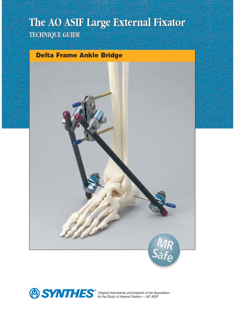 Delta Frame Ankle Bridge PDF | PDF | Ankle | Screw
