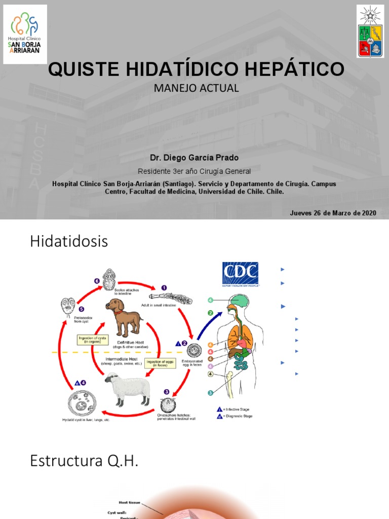 Quiste Hidatídico Hepático | PDF