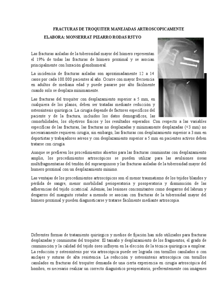 Fracturas de Troquiter Por Artros | PDF | Medicina CLINICA ...