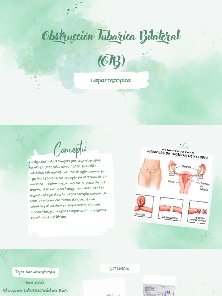 Obstrucción Tubarica Bilateral (OTB) | PDF