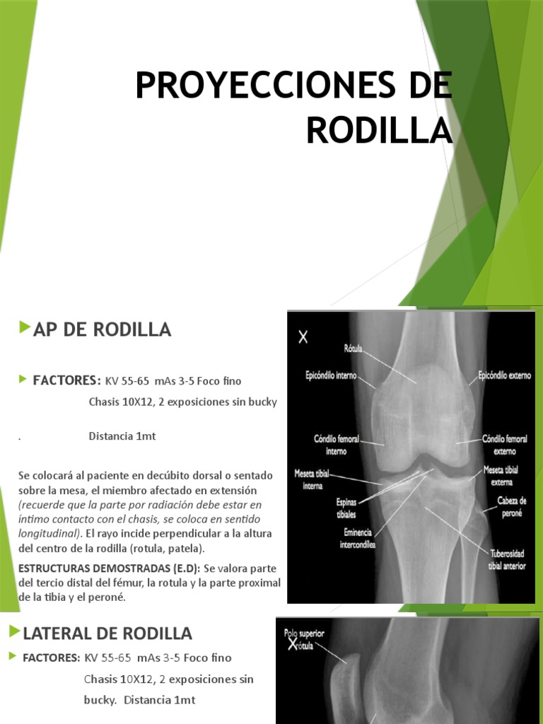 Presentacion PROYECCIONES DE RODILLA | PDF | Rodilla | Anatomía humana