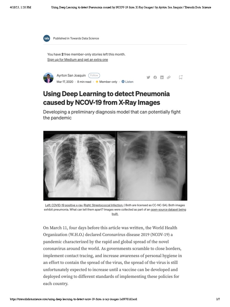 Using Deep Learning To Detect Pneumonia Caused by NCOV-19 From X-Ray ...