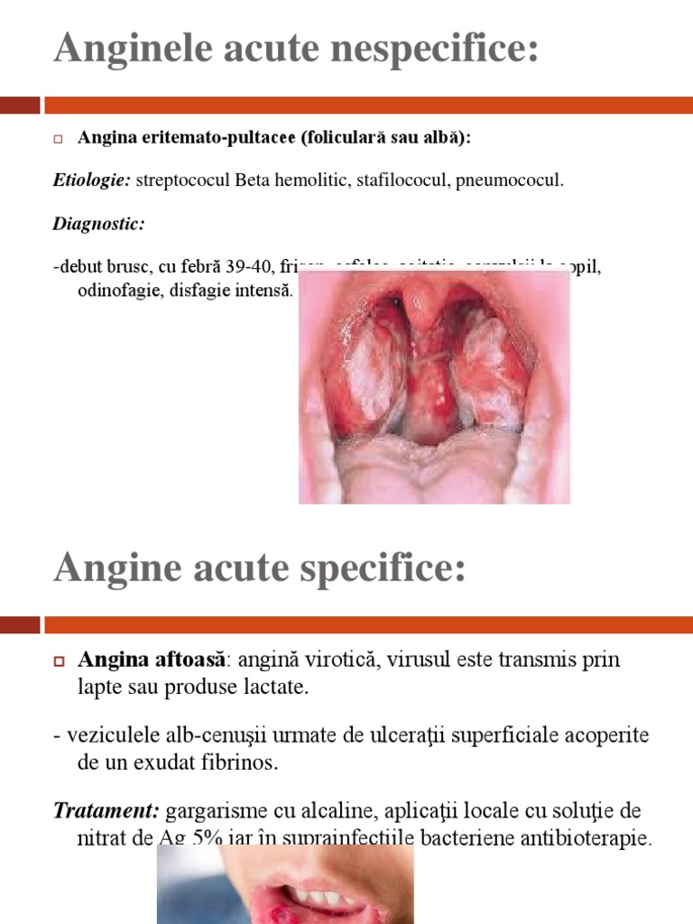 4 Poze PDF | PDF