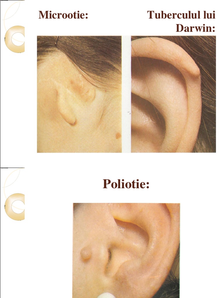 7 Poze | PDF