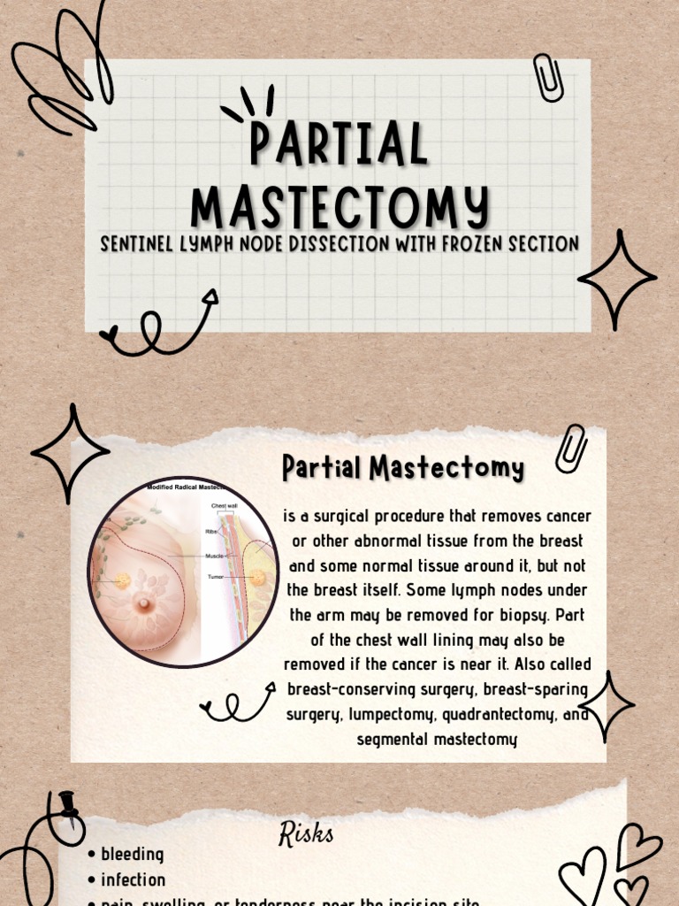 Partial Mastectomy | PDF | Surgery | Mastectomy