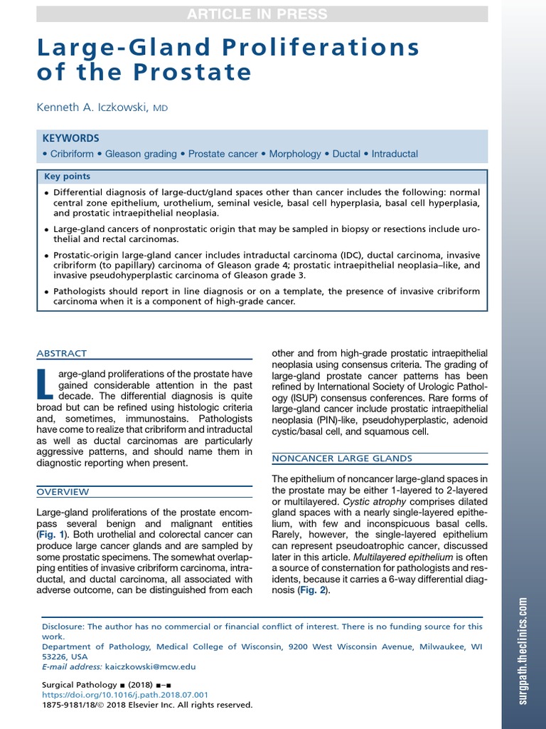 Prostate Large-Gland Proliferations Analysis | PDF | Prostate Cancer ...