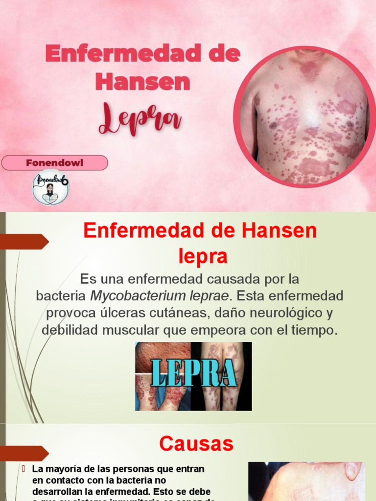 Enfermedad de Hansen | PDF | Lepra | Síntoma