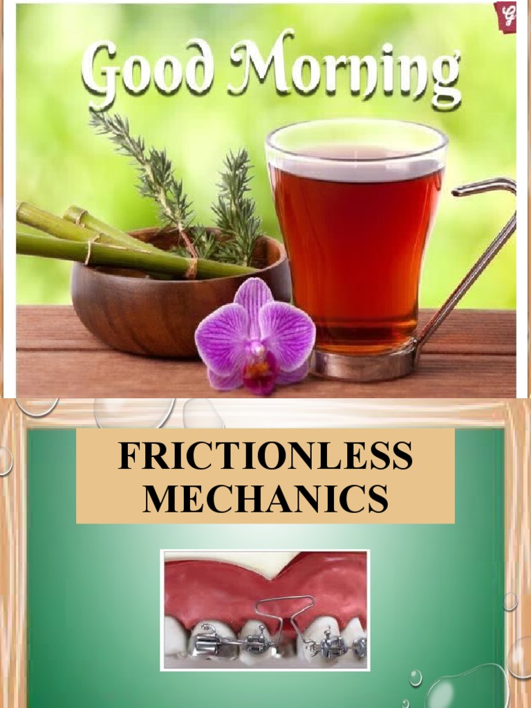 Frictionless Mechanics Seminar | PDF | Orthodontics | Force
