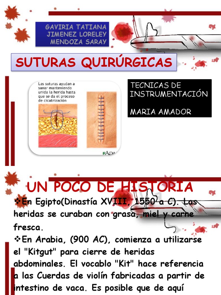 Suturas Quirurjicasssss | PDF | Sutura Quirúrgica