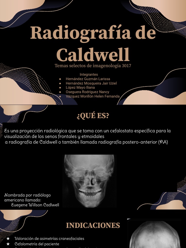Proyección Radiográfica de Caldwell | PDF | Medicina CLINICA | Cabeza y ...