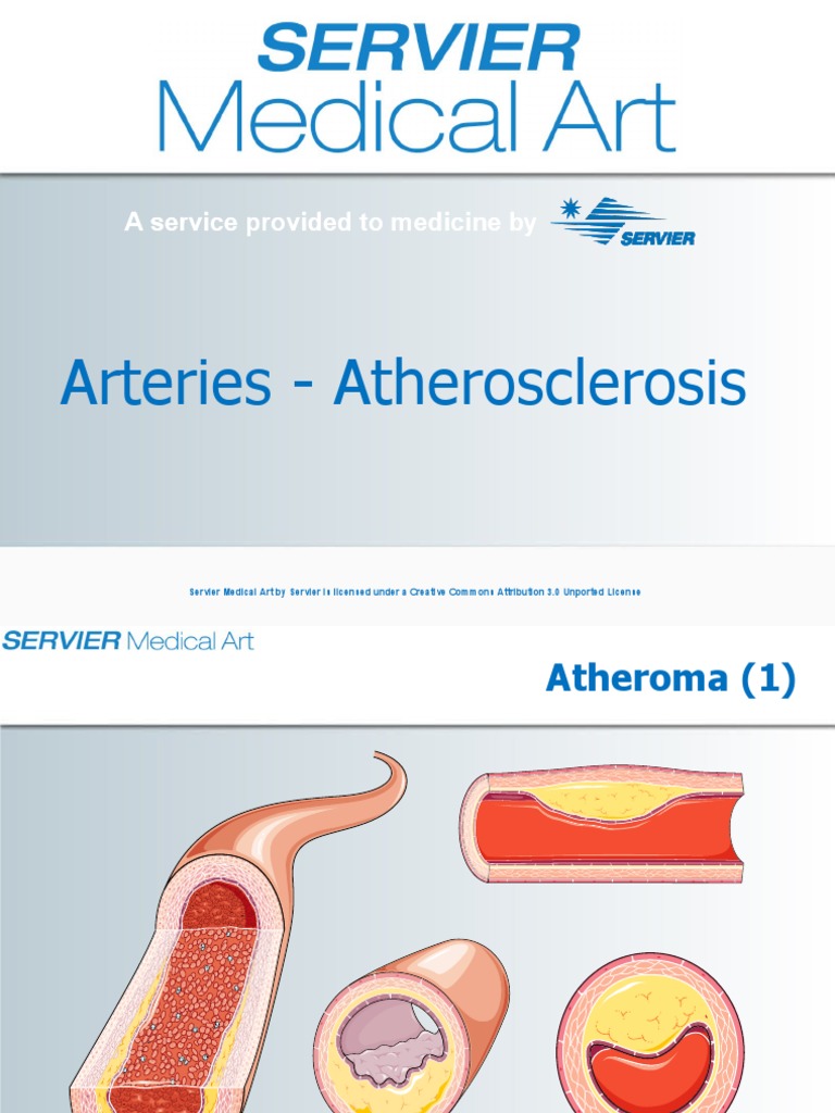 Arteries Atherothrombosis | PDF | Atheroma | Atherosclerosis