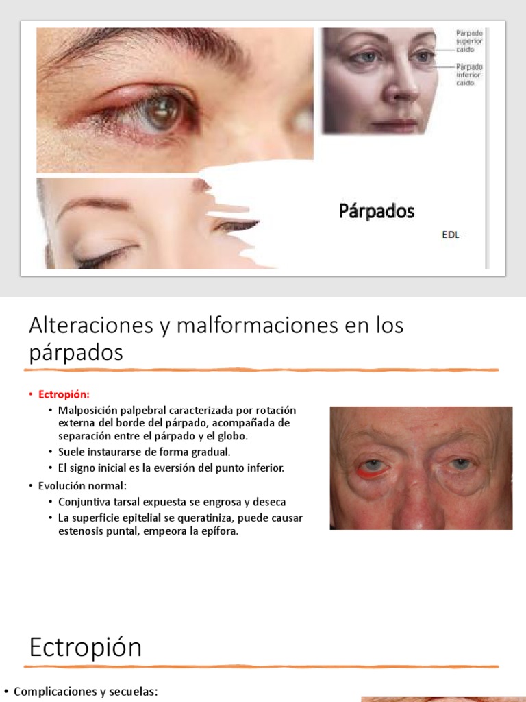 Enfemredades de Los Parpados Parte 1 | Descargar gratis PDF | Epitelio | Oftalmología